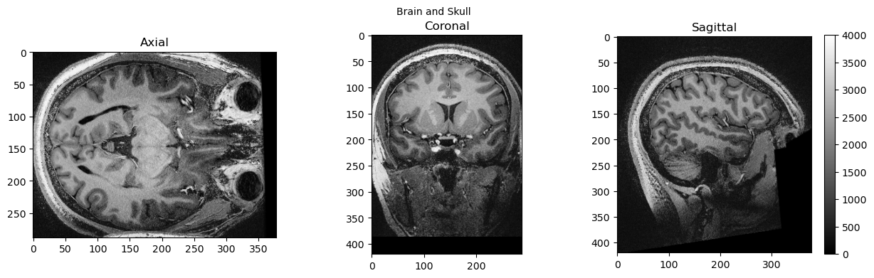 Basic Nipype Example — Neurodesk