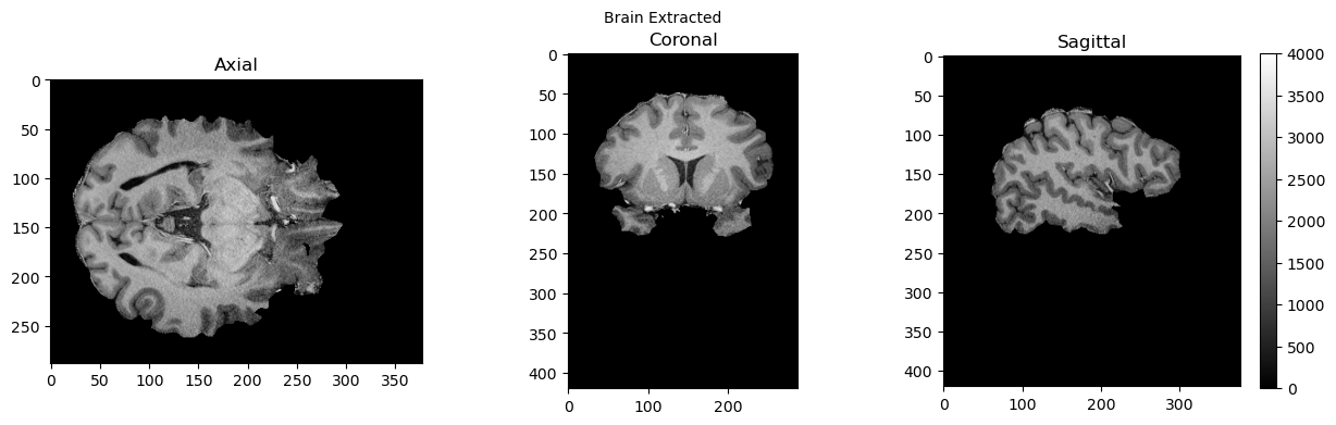Basic Nipype Example — Neurodesk